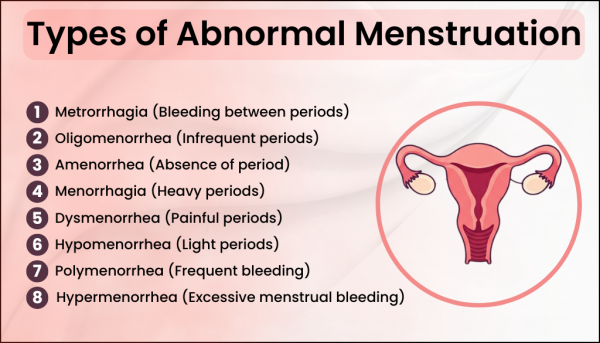 8 Types of Abnormal Menstruation You Shouldn’t Ignore