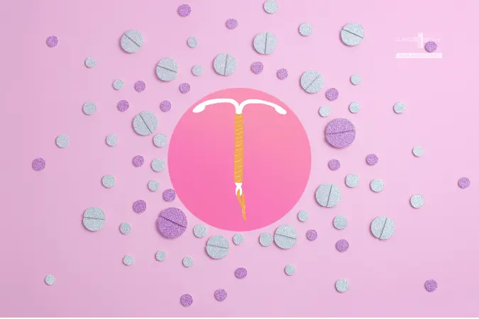 How Does an IUCD Prevent Pregnancy? | Clinic One