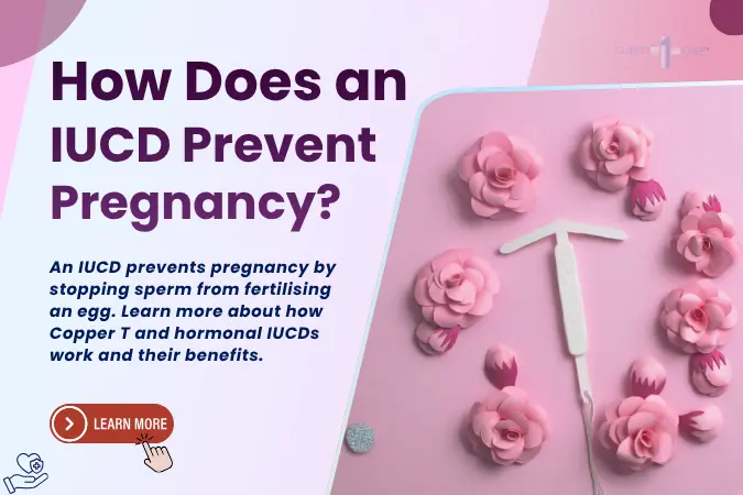 How Does an IUCD Prevent Pregnancy? | Clinic One